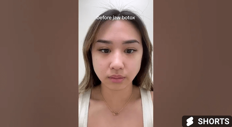 Botox Toronto | Botox Near Me | Best Botox Clinic Toronto Canada